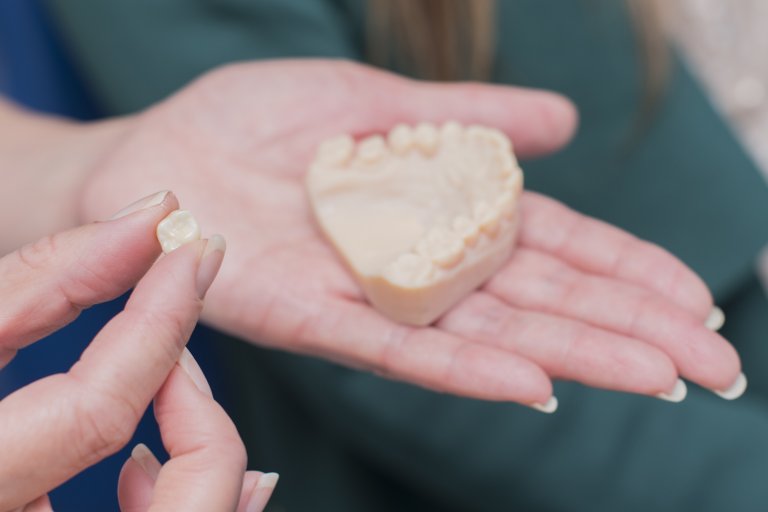 Aspendale Gardens - Dental Implants | Aspendale Gardens Dental Group